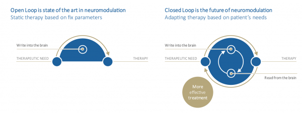 Why Closed Loop? | CorTec | Thinking ahead – Innovation in Neurotechnology