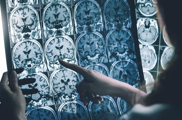 Presurgical Diagnostics | CorTec | Thinking ahead – Innovation in ...