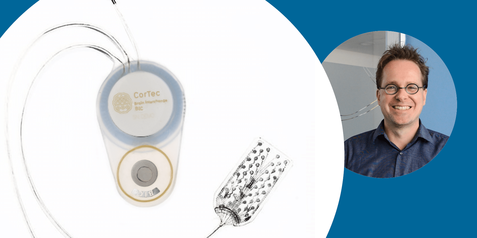 News from the Brain Interchange Development | CorTec | Thinking ahead ...