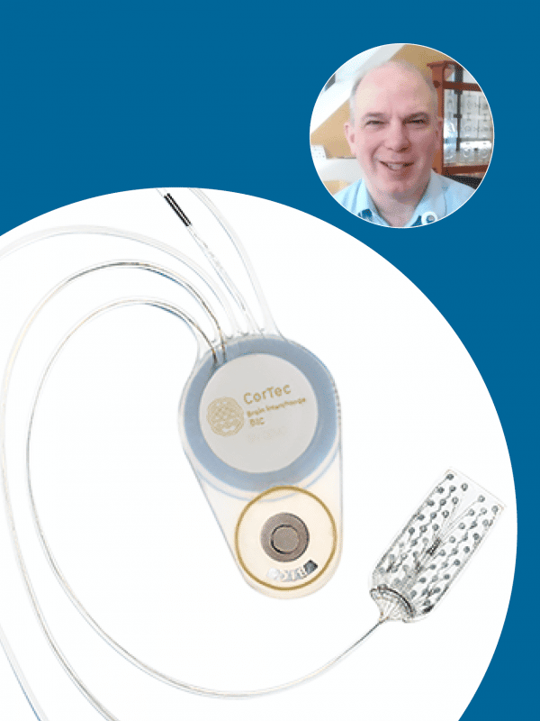 CorTec’ Brain Interchange implant system on track for first-in-man ...