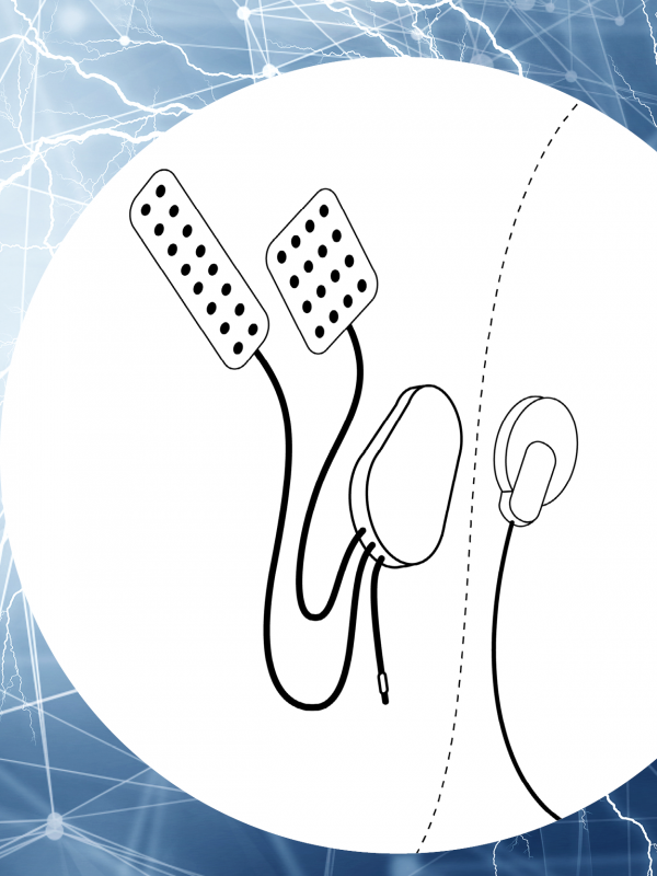 The Brain Interchange System for Stroke Rehabilitation | CorTec ...